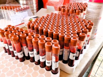 How to Draw Blood from a Goat - Goat Journal